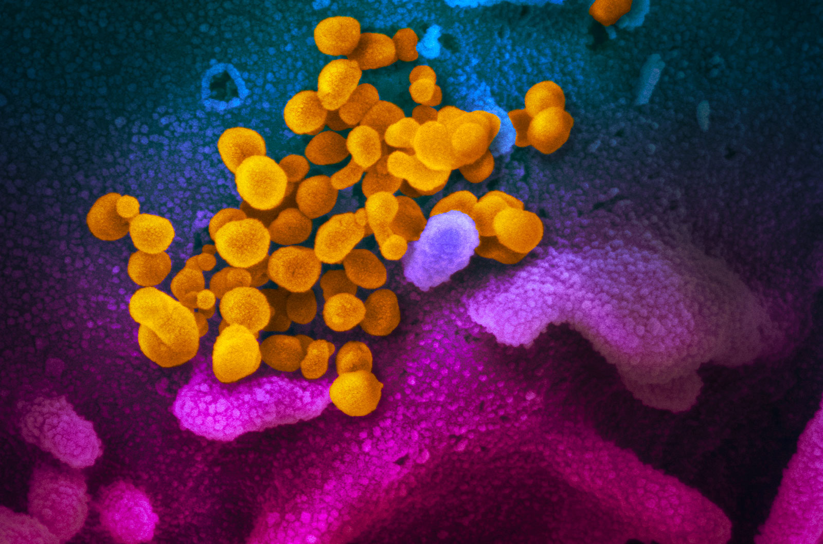 Le projet - Proact EU Response